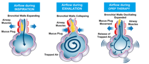 Smoke Doesn't Cause Asthma Attacks, It Causes Respiratory Attacks